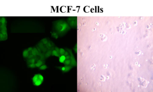 MCF-7 Cells Culture - MCF-7 Cells